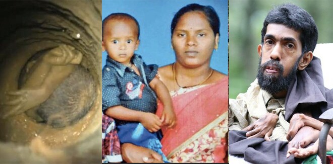ഇനിയൊരു ‘സുജിത്തും’ പിടഞ്ഞു മരിക്കില്ല! നൂറടി താഴ്ചയിൽ നിന്നും ...