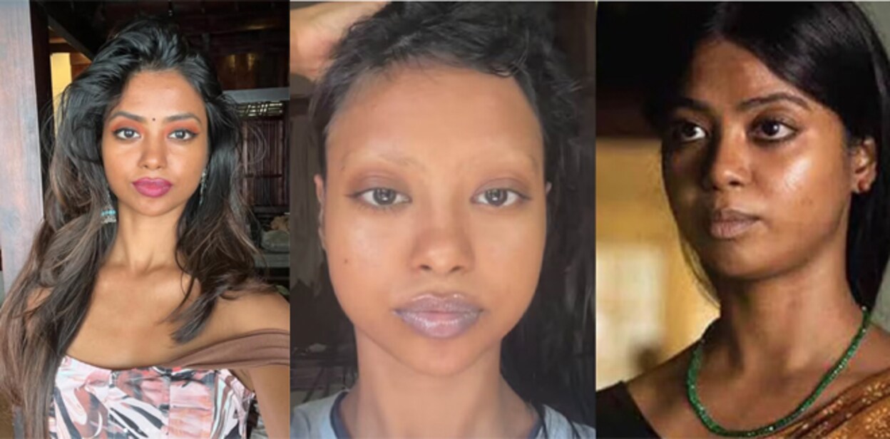 തലമുടി കൊഴിഞ്ഞുപോയി, ആർത്തവം താളംതെറ്റി: അപൂർവ രോഗം പറഞ്ഞ് നടി ഷോൺ റോമി ...